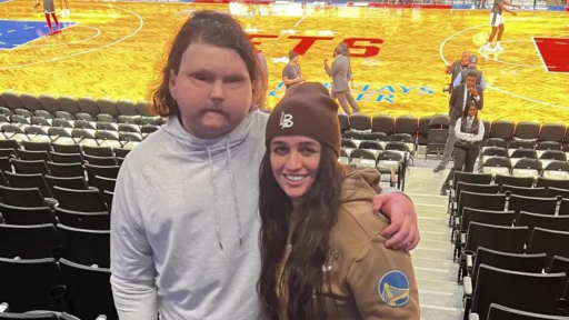 Joe DiMeo: el primer hombre en sobrevivir una cirugía simultánea de ...