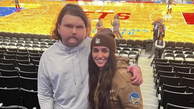 Joe DiMeo: el primer hombre en sobrevivir una cirugía simultánea de ...