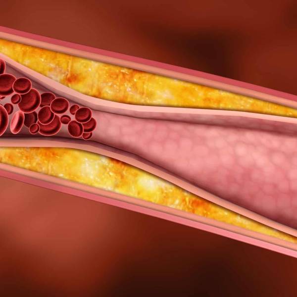 Crean campaña para concienciar sobre colesterol